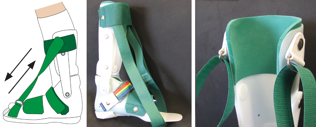 Optimizations for excess plantarflexion control